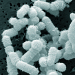 The Best Probiotic For Sinus Infections – Lacto Bacto