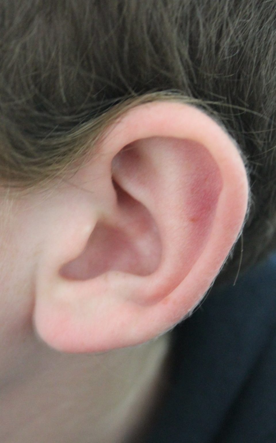 The Ear Microbiome Varies Between Those With and Without Ear Infections ...